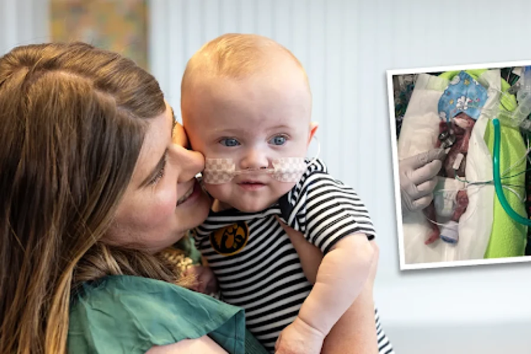 World’s Youngest Premature Baby Celebrates His First Birthday Against ...