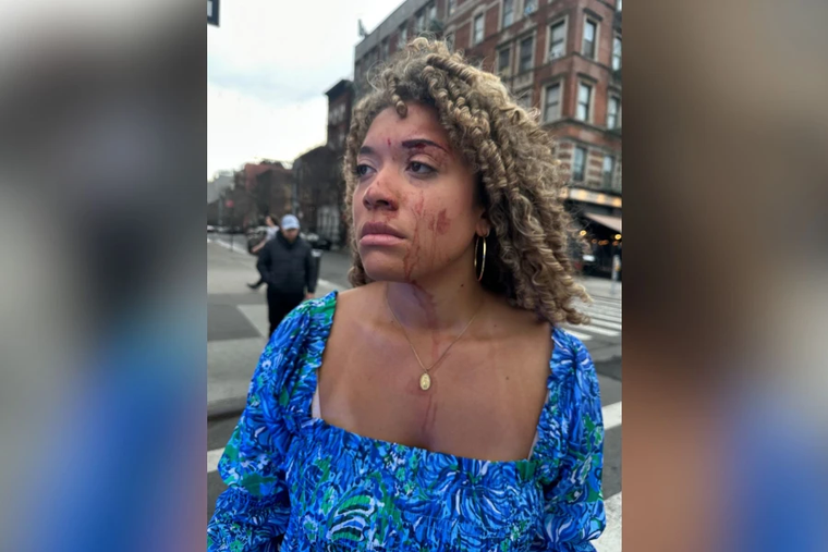 New York Prosecutor Drops Charges Against Suspect in Bloody Assault On Pro-Life Advocate ...